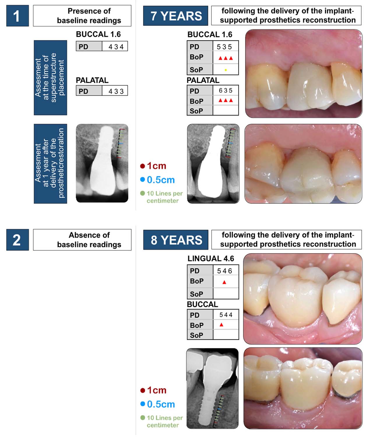 Reliability assessment of the 2018 classification case definitions of ...